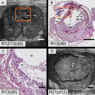 Timeline Of Embryo Resorption Ultrasonographic Markers Of Normal