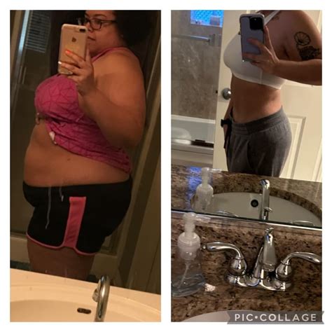 Im Nervous About The Nausea Side Effects I Was Very Sick With Both Of