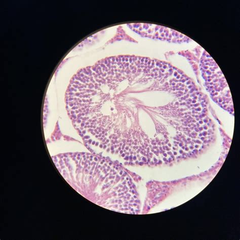 Endocrine System Testes Histology Diagram Quizlet