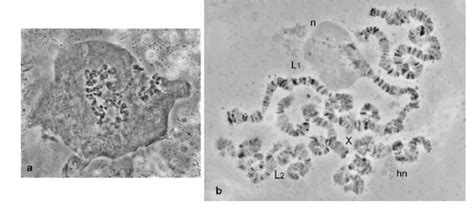A Pupal Trichogen Cell Of A Scutellar Bristle Of Glossina Pallidipes Download Scientific