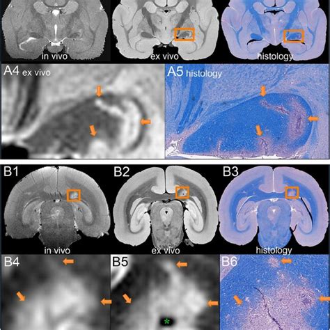 Hande Lfb Staining Protocol Times Are Approximate Download