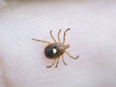 Cdc Warns Of ‘emerging Illness Caused By Tick Bite That Causes