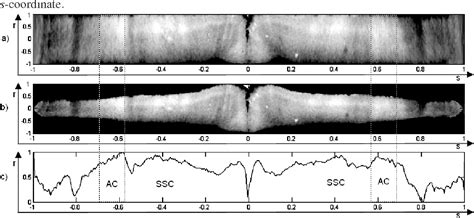 Figure 8 From A Method For The Automatic Segmentation Of Autoradiographic Image Stacks And