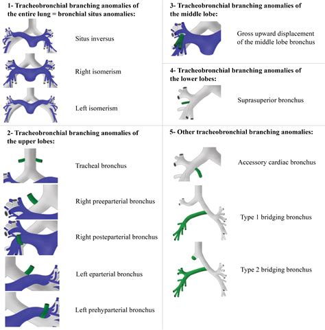 Tracheobronchial Branching Abnormalities Lobe Based Classification