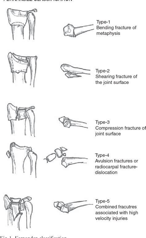 Classification Of Distal Ulnar Fracture At Dana Cohen Blog