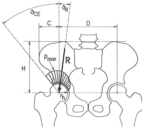 Schematic Presentation Of The Stress Distribution In The Hip Joint