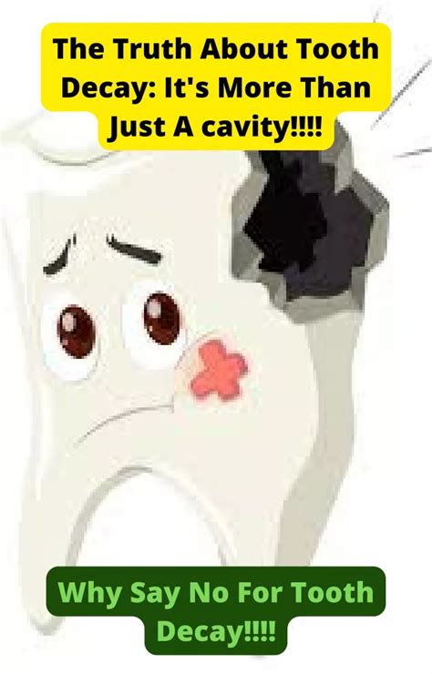 Ppt Tooth Decay Ebook Powerpoint Presentation Free Download Id