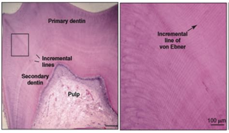 1 4 The Dentine Pulp Complex Lsrc Flashcards Quizlet