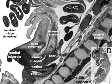 Urinary Bladder Development Embryology