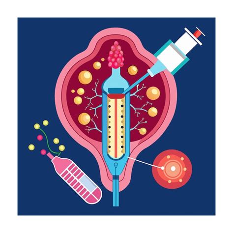 Hormonal Devices And Methods Concept Vector Illustration Premium Ai