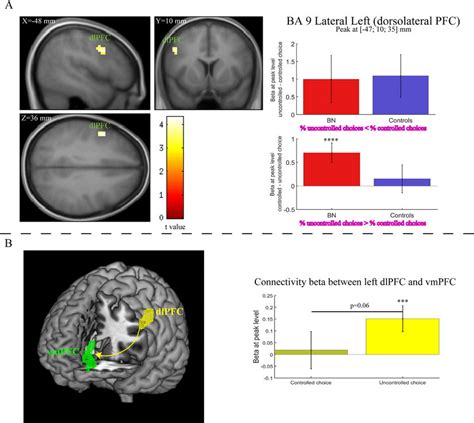 A Difference In Activity In The Left Dorsolateral Prefrontal Cortex Download Scientific