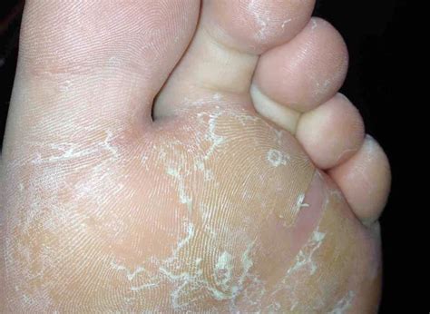 Athletes Foot Davenport House Clinic