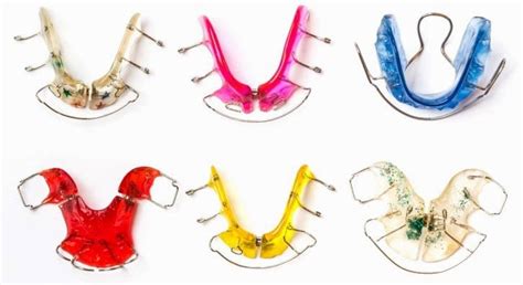 Ortodontie Ce Tipuri De Aparate Dentare Exista Pentru Copii Dentalsana Bucuresti