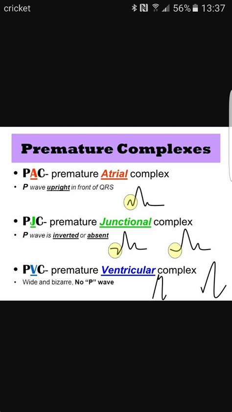 Premature Complex In Medicine