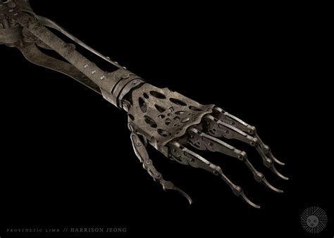 Victorian Prosthetic Arm