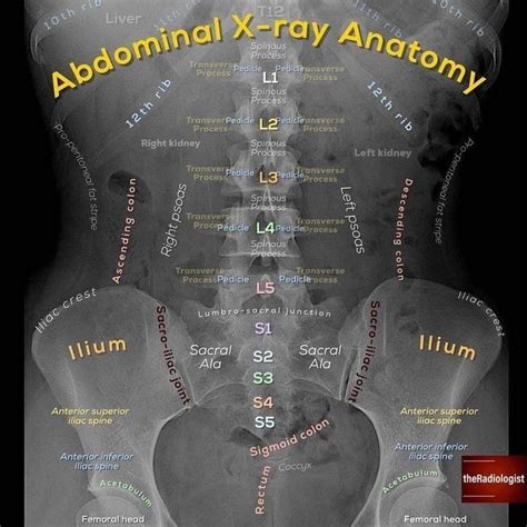 Engr Muhammad Asim Zia On Linkedin This Image Is A Labeled Diagram Of