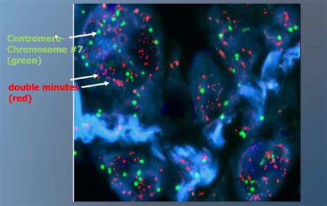 Bone Marrow Examination And Cytogeneticsmolecular Analysis Flashcards