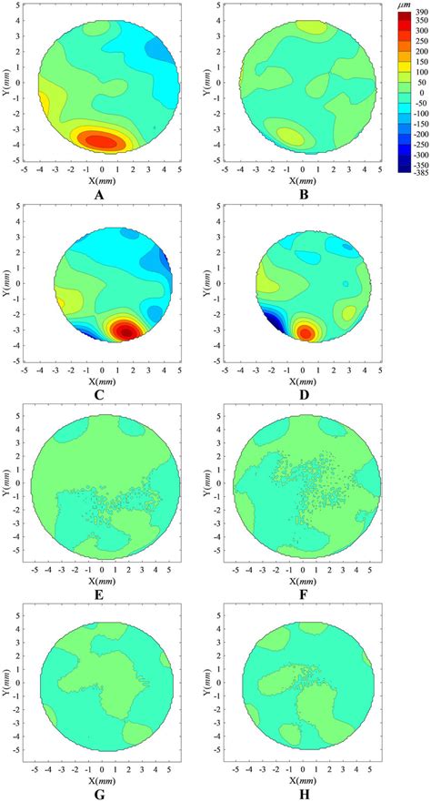 Distribution Of Elevation Differences Between Successive Corneal