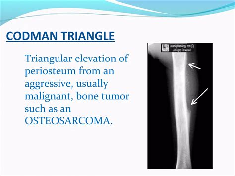 Radiology Signs Ppt