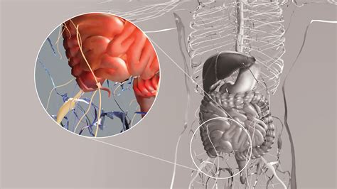 Learn Whats Old And New With Appendicitis Treatment Acs