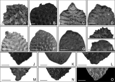 Photomicrographs And Electron Photomicrographs Of Apical Appendage And