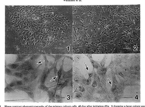 Table 1 From Long Term Cell Culture Of Resident Peritoneal Macrophages