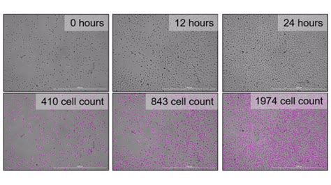 Cell Counting
