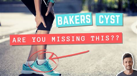 Bakers Cyst Therapy Exercises At Joann Finkelstein Blog