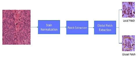 overview of our preprocessing phase download scientific diagram