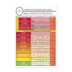 Basic Ekg Ecgekg Practice Quiz Identify Rhythms