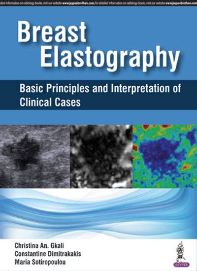 Breast Elastography Basic Principles And Interpretation Of Clinical Cases
