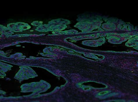 spatial biology 101 webinar intro to geomx dsp