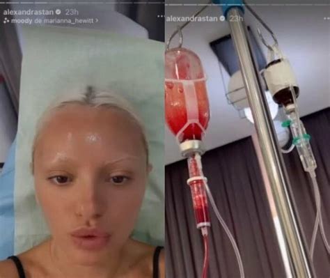 Foto Alexandra Stan La Spital După Ce A Pozat Nud în Grecia
