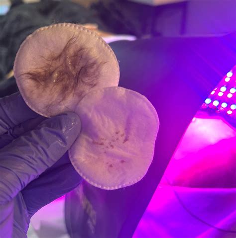 Whats In Here Dermaplaning Make The Skin Element