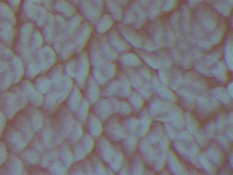 Cchmc Roboflow Universe