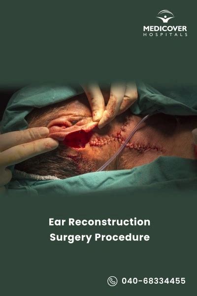 Ear Reconstruction Types Procedure Risks And Benefits
