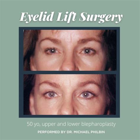 Philbin Bleph Edina Plastic Surgery