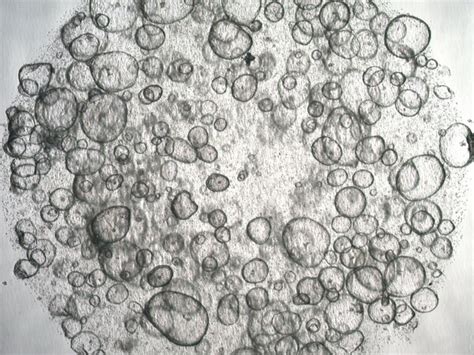 3dgro™ Duodenum Intestinal Organoids Age 59 Prep Ht 215 D Scc348