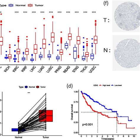 A Differential Expression Of Ezh2 In Pan Cancer Between Tumor Groups
