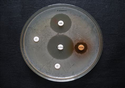Disk Diffusion Method Microbiology At Patricia Bartholomew Blog