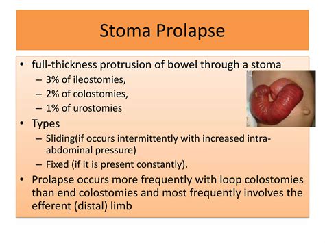 Stoma Complications By Prof Ajay Khanna Ims Bhu Varanasi India Pptx