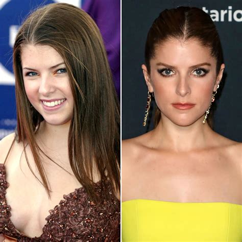 Anna Kendricks Transformation Is Simply Stunning See Photos Of The