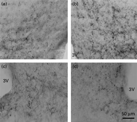 Photomicrographs Showing 60 Mm Sections Of The Mediobasal Hypothalamus