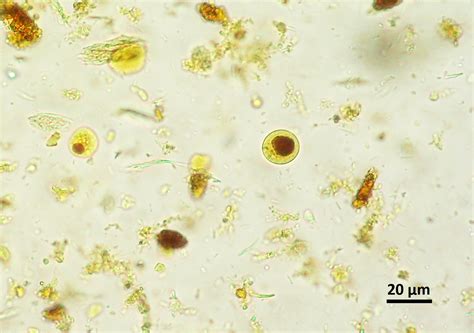 Microbiology An Introduction 13th Edition Pdf