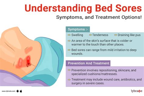 Stage Bedsore Nursing Home Neglect Pressure Ulcers 44 Off