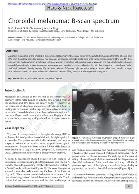 Pdf Choroidal Melanoma B Scan Spectrum