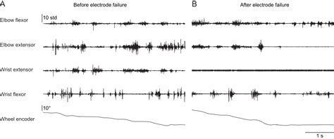 recording forelimb muscle activity in head fixed mice with chronically