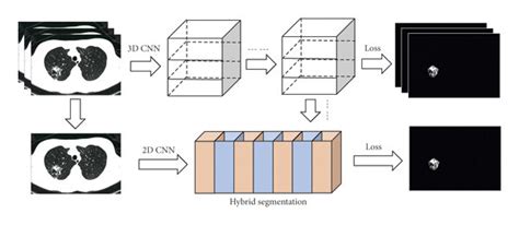 the basic structure of the hybrid segmentation network download