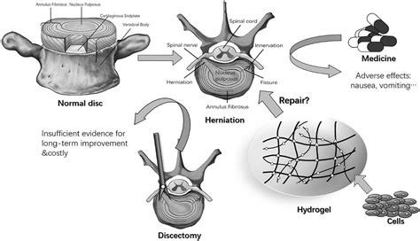Frontiers Application And Development Of Hydrogel Biomaterials For