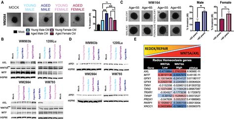 Sex Dependent Effects In The Aged Melanoma Tumor Microenvironment